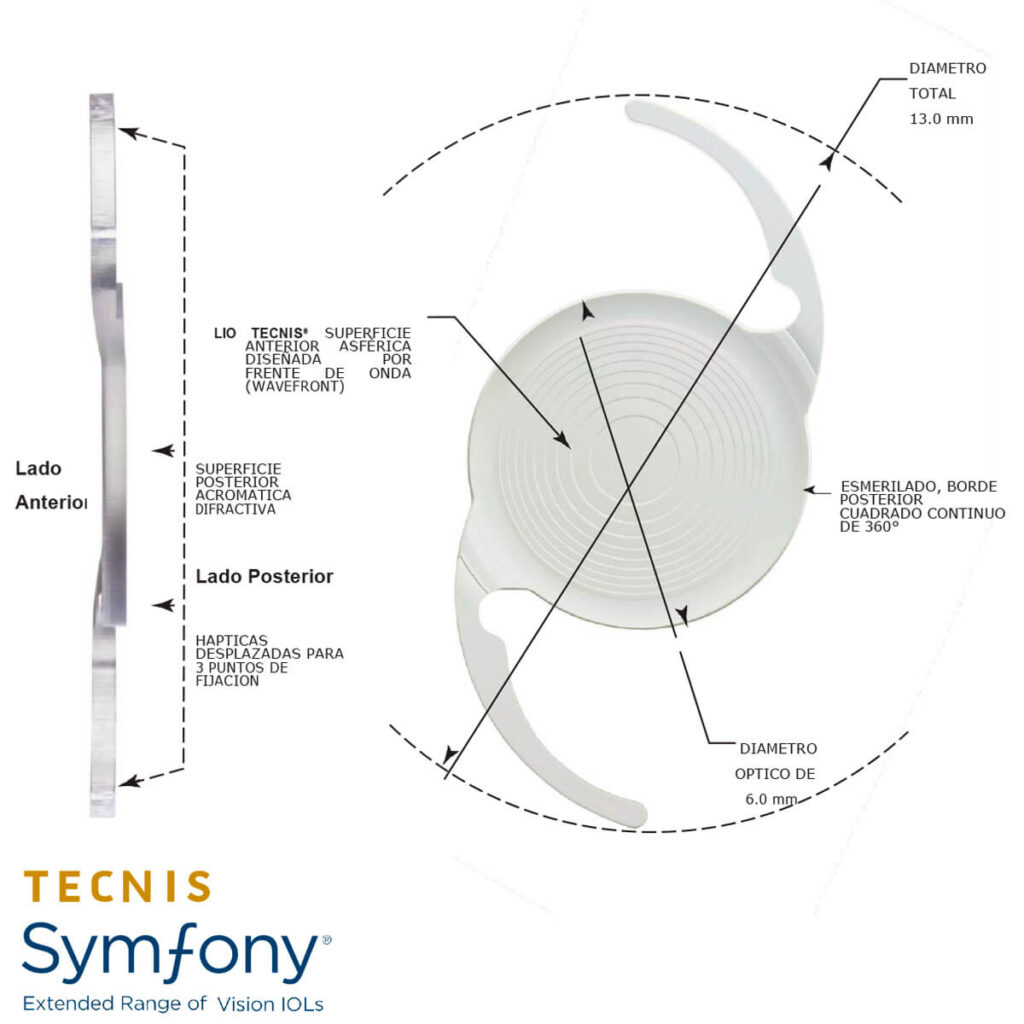 Lentes Intraoculares | OftalmoSalus