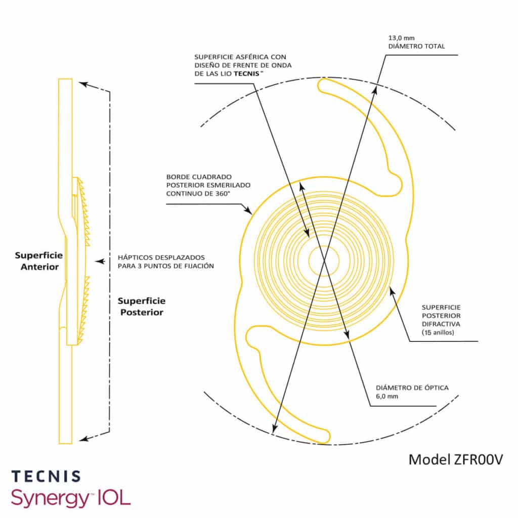 Lentes Intraoculares - OftalmoSalus: insumos y tecnología oftalmológica ...